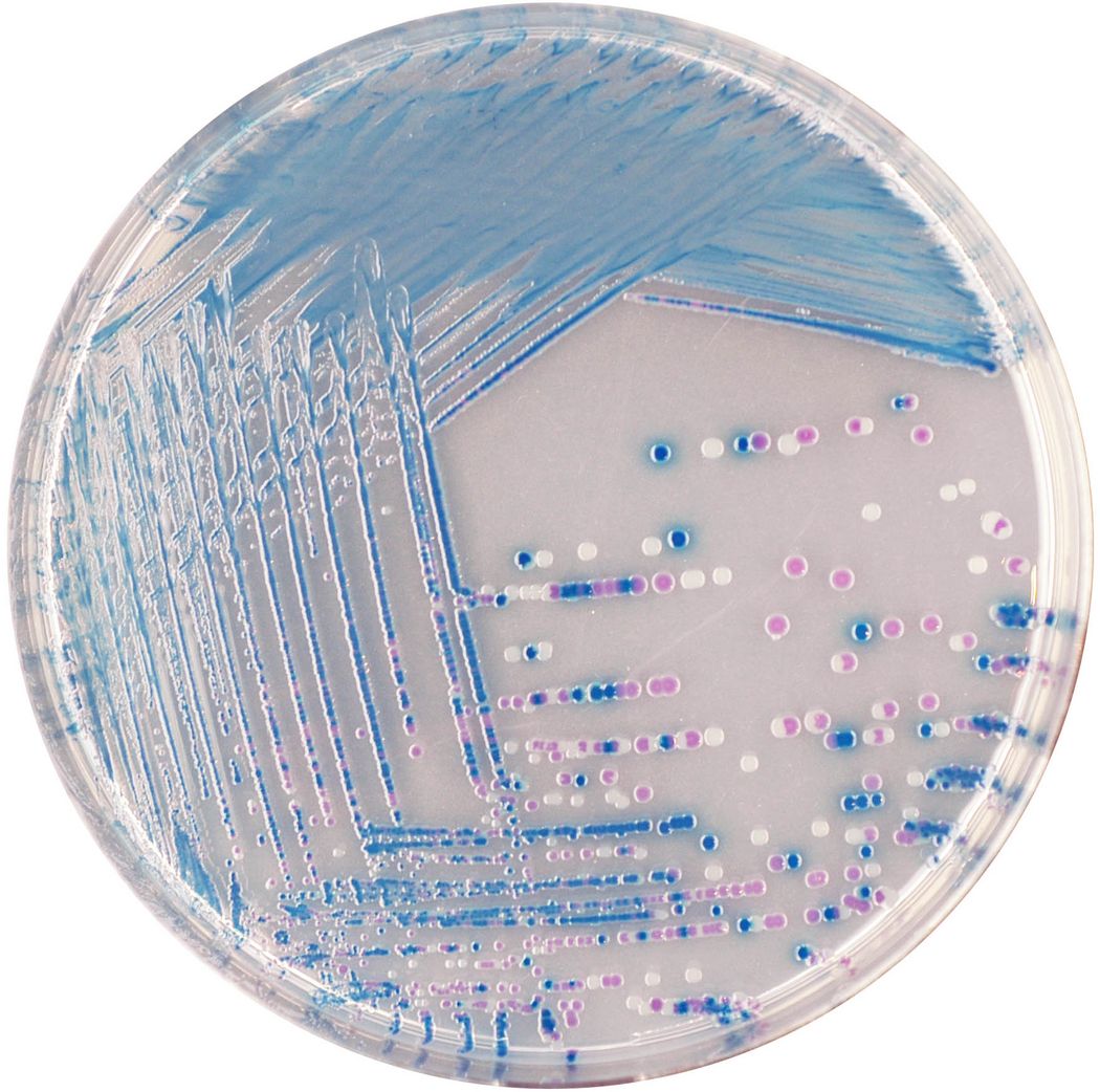 Product: CHROMagar™ O157 - 5000 ml - Copenhagen Biotech Supply